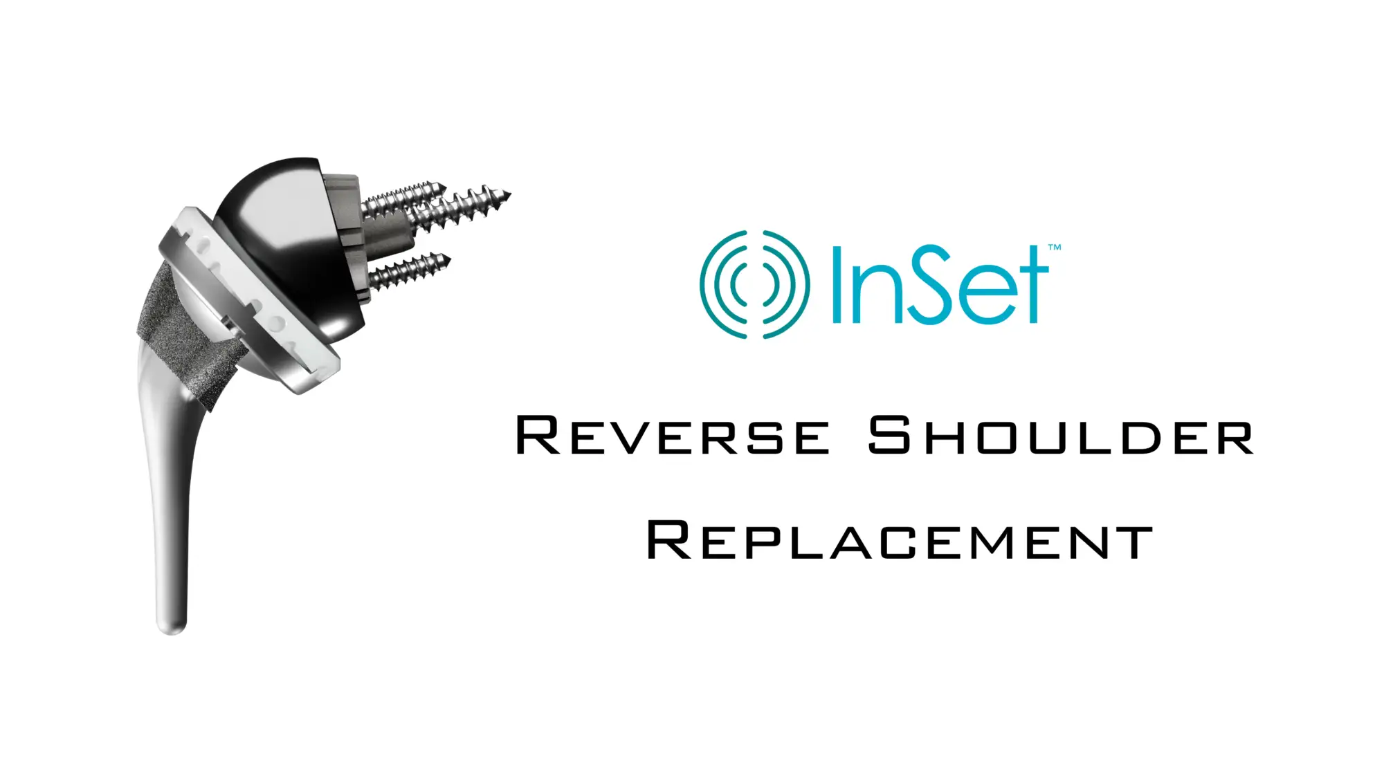 What Is Shoulder Replacement Surgery? - Shariff K. Bishai, DO